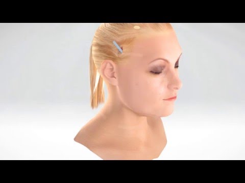 Liposuction & Facelift – Animation 3D – Mcallen texas
