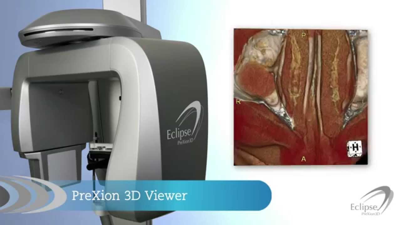Prexion3D Viewer Software