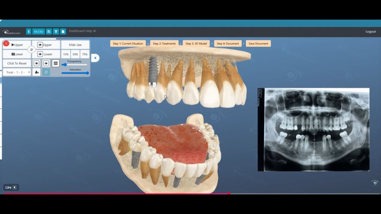 How to Create 3 Patient Treatment Plans in 3 Minutes (Step-by-Step, No Edits) + PDF Export