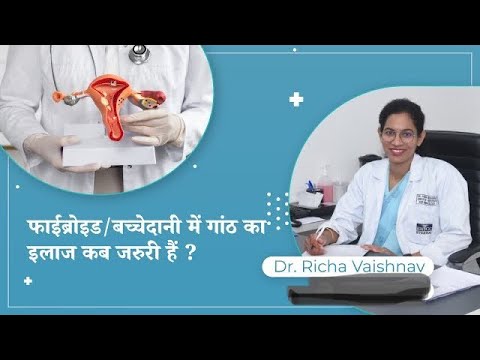 फाइब्रॉएड/बच्चेदानि में गाँठ का इलाज Fibroid Uterus Treatment ,Fibroid ka ilaj in hindi