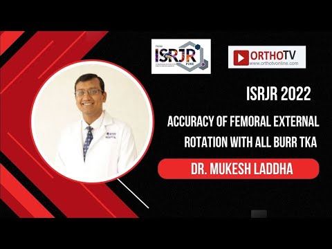 ISRJR 2022 : ACCURACY OF FEMORAL EXTERNAL ROTATION WITH ALL BURR TKA - DR. MUKESH LADDHA