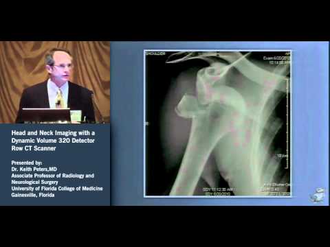 Head & Neck Imaging-Dynamic Volume 320 Row CT Scanner - Keith Peters, MD (1 of 3)
