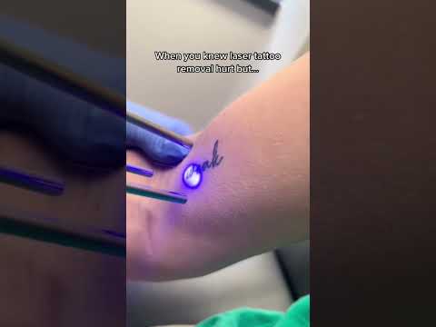 Laser tattoo removal #shorts