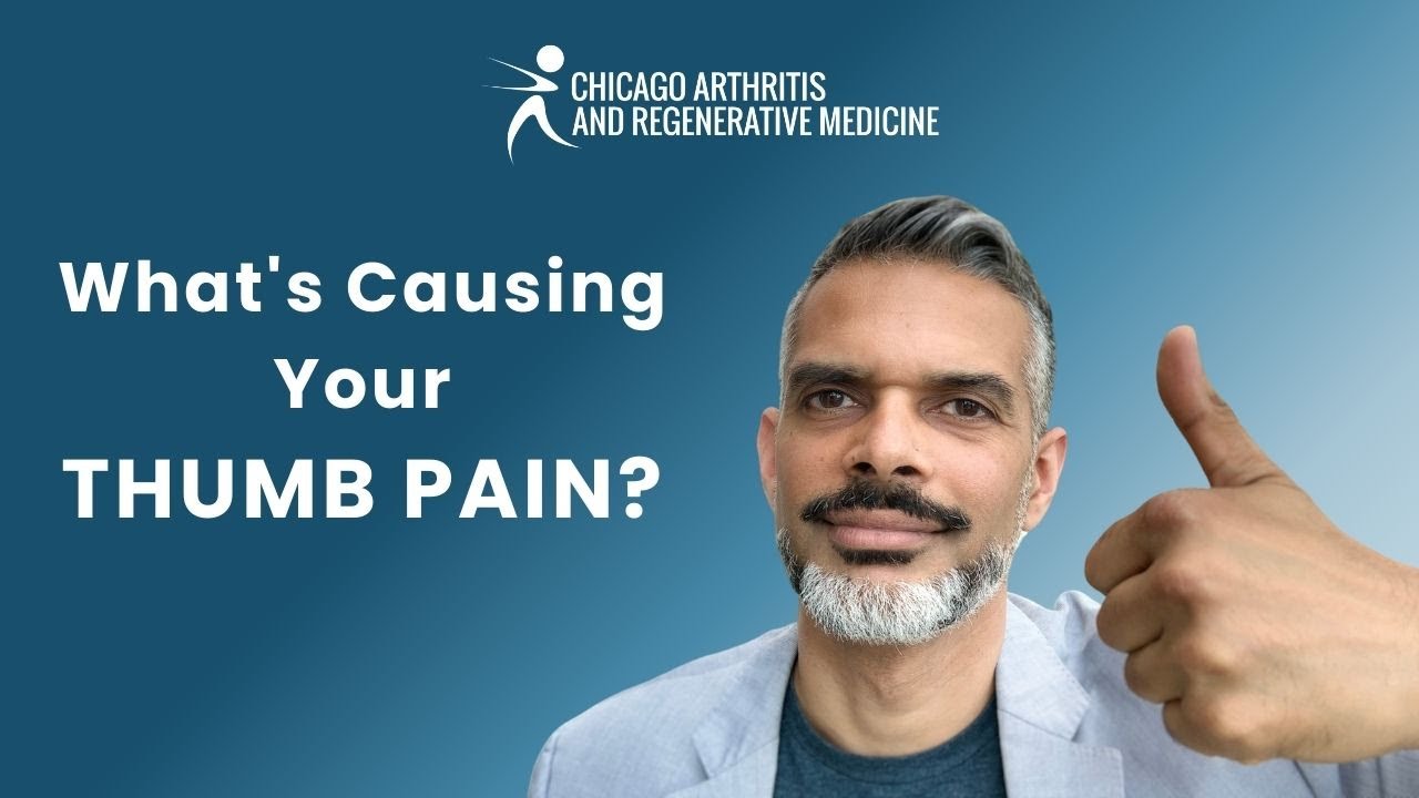 What's Causing Your Thumb Pain? - Chicago Arthritis and Regenerative ...