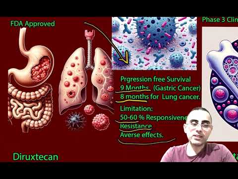 New Hope in Cancer Treatment! What are Antibody-Drug Conjugates (ADCs)