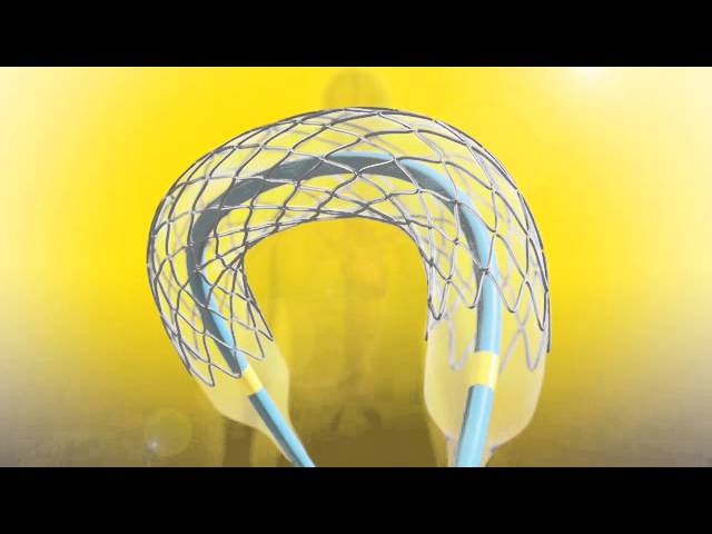 Medtronic Resolute Integrity Coronary Stent - Drug Eluting Stent ...