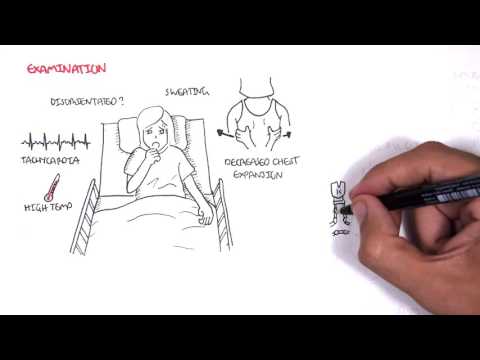 Community Acquired Pneumonia (DETAILED) Overview