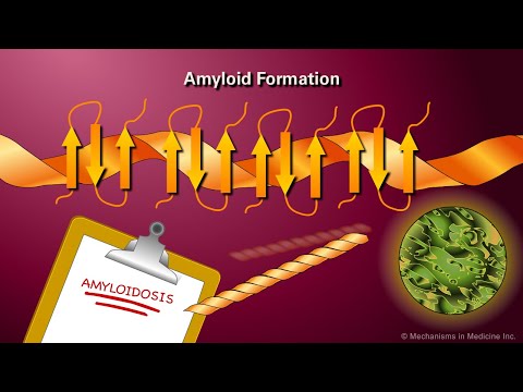 Amyloidosis