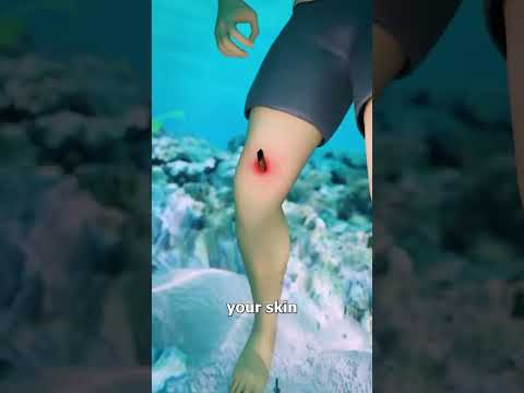 How Stingrays Actually Sting You 😳