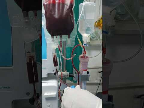 What are the benefits of #blood #transfusion during dialysis. Comment #science #dialysis #diatomic