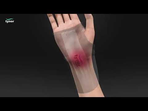 TYNOR Elastic Wrist Splint Right/Left.