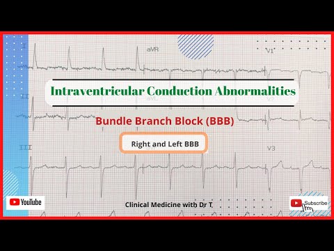 The ECG Series//Intraventricular Conduction Abnormalities//Bundle Branch Block//