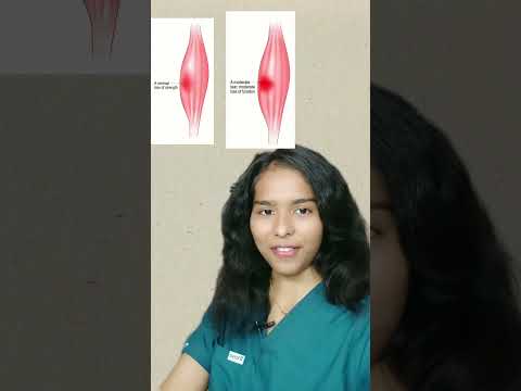 Muscle Strain Explained: Grades, Causes & Signs | Must-Know for Physios!