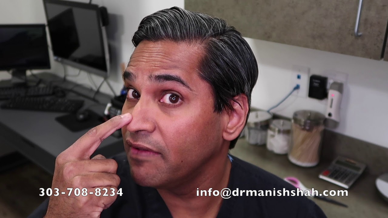 Managing Swelling After Rhinoplasty