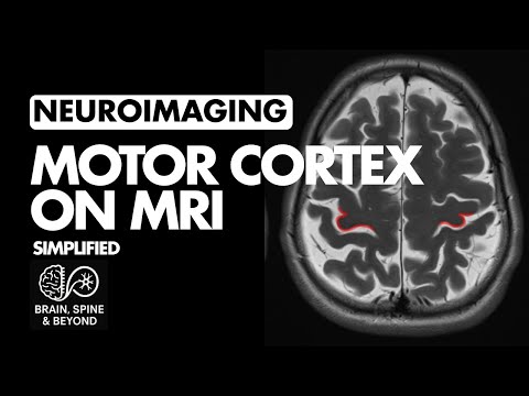 How to Identify the Motor Cortex & Central Sulcus on MRI imaging?