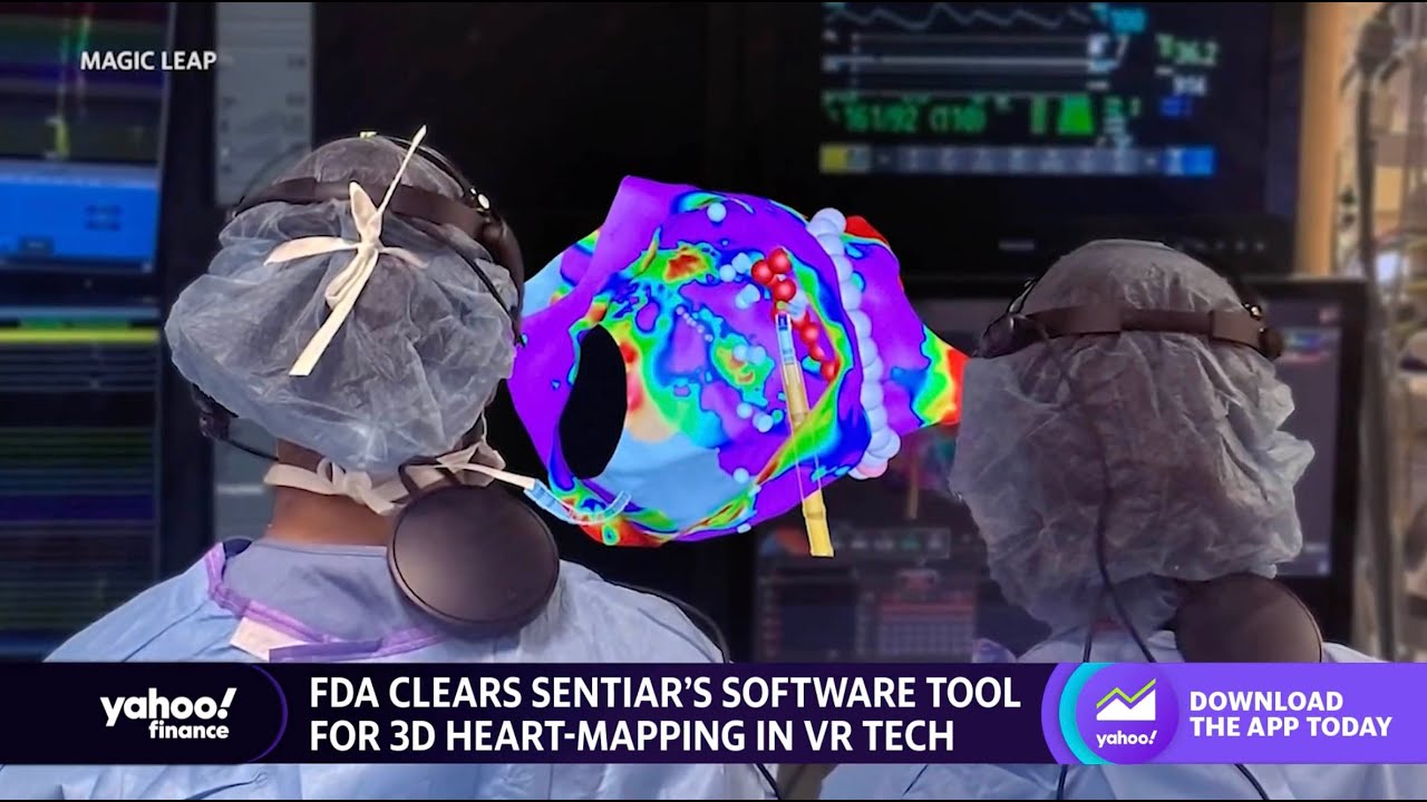 3D heart mapping AR software cleared by FDA that allows doctors to see a 3D image of the heart