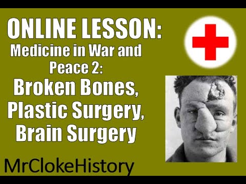 GCSE History: WWI Medicine- Broken Bones, Plastic Surgery and Brain Surgery