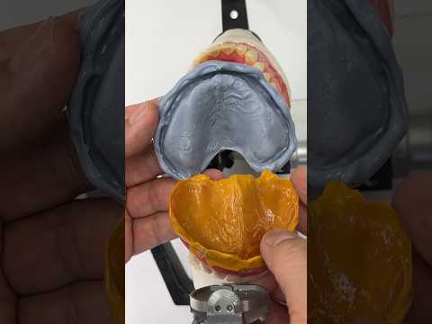 Awesome Impression #dental #teeth #smile #shorts #shortvideo #lsk121shorts #denture #dentures
