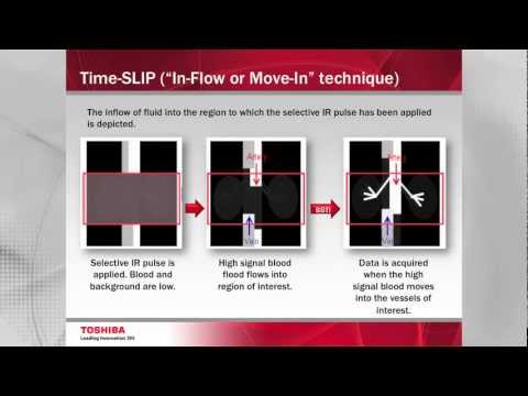 Advanced Non-Contrast Imaging Techniques