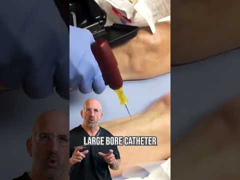Tapping a Bone for 🚨 Fluids/Medications (Intraosseous Line) #shorts #surgeryshorts