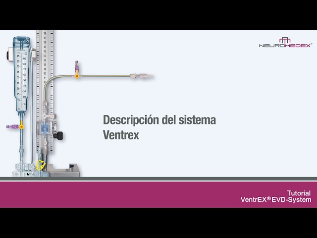 VentrEX® EVD | Ventrex