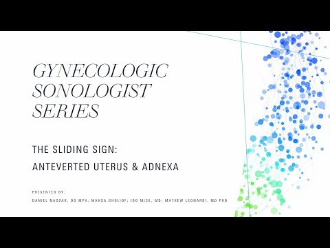 Gynecologic Sonologist Series: Episode 1 - Sliding Sign Anteverted Uterus and Ovaries/Adenxa