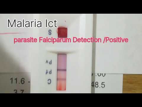 malaria Ict test | malaria device Test