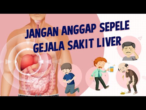 Jangan Anggap Sepele, Berikut Gejala Sakit Liver yang Perlu Diketahui