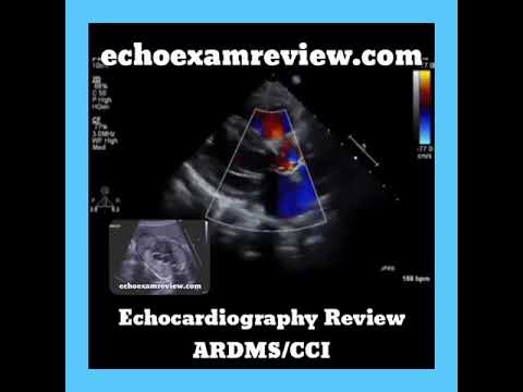 Left Ventricular Assist Device (LVAD)