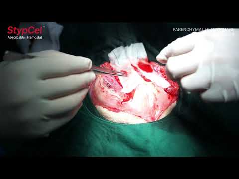 Animal experiment - parenchymal hemorrhage in canine brain