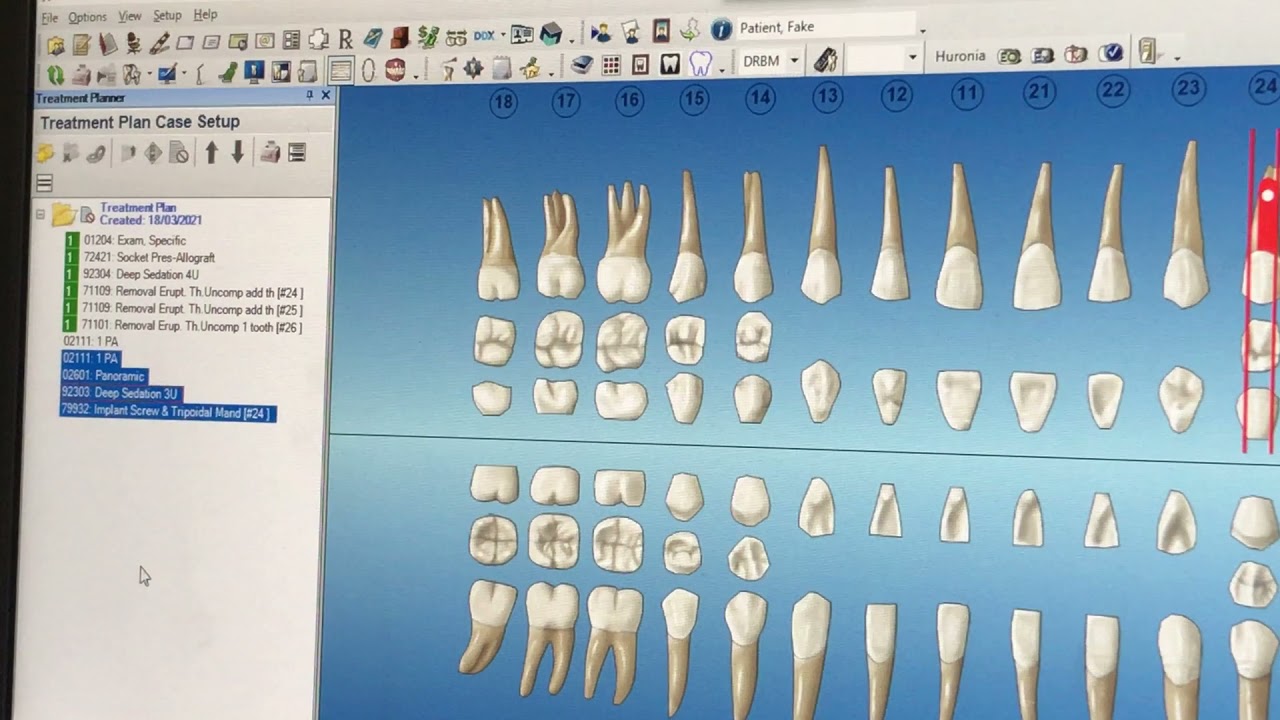 Creating a Multi-phased Treatment Plan in Dentrix