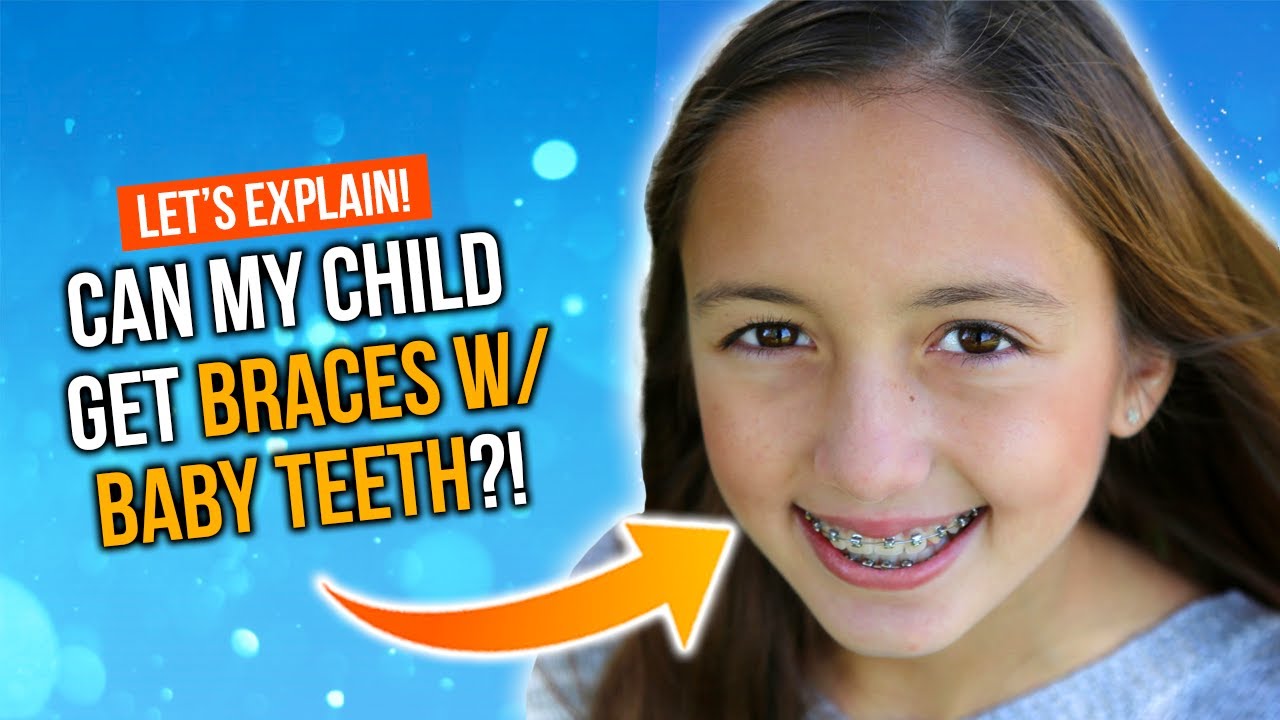 Can My Child Get Braces With Baby Teeth?