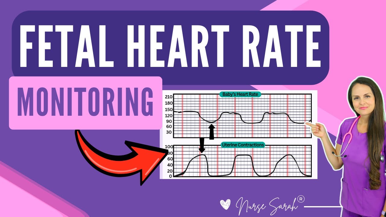 Fetal Heart Rate Monitoring Nursing NCLEX: Accelerations, Decelerations - Early, Variable, Late