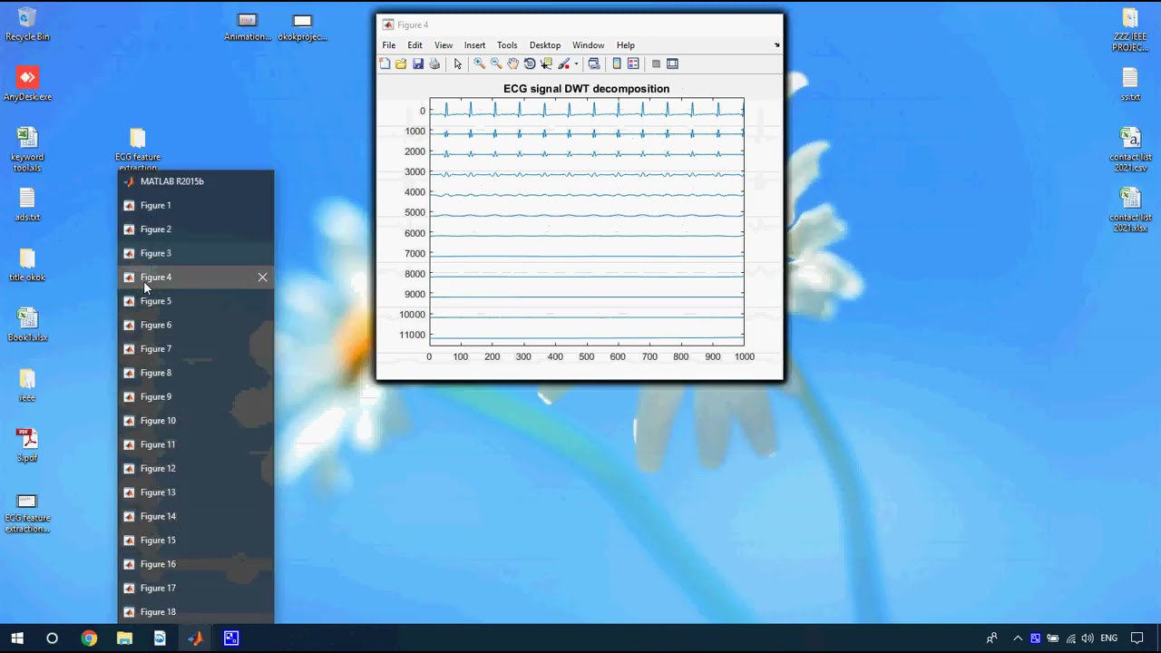Ecg Feature Extraction In Matlab Okok Projects Final Year Projects Bangalore Chennai