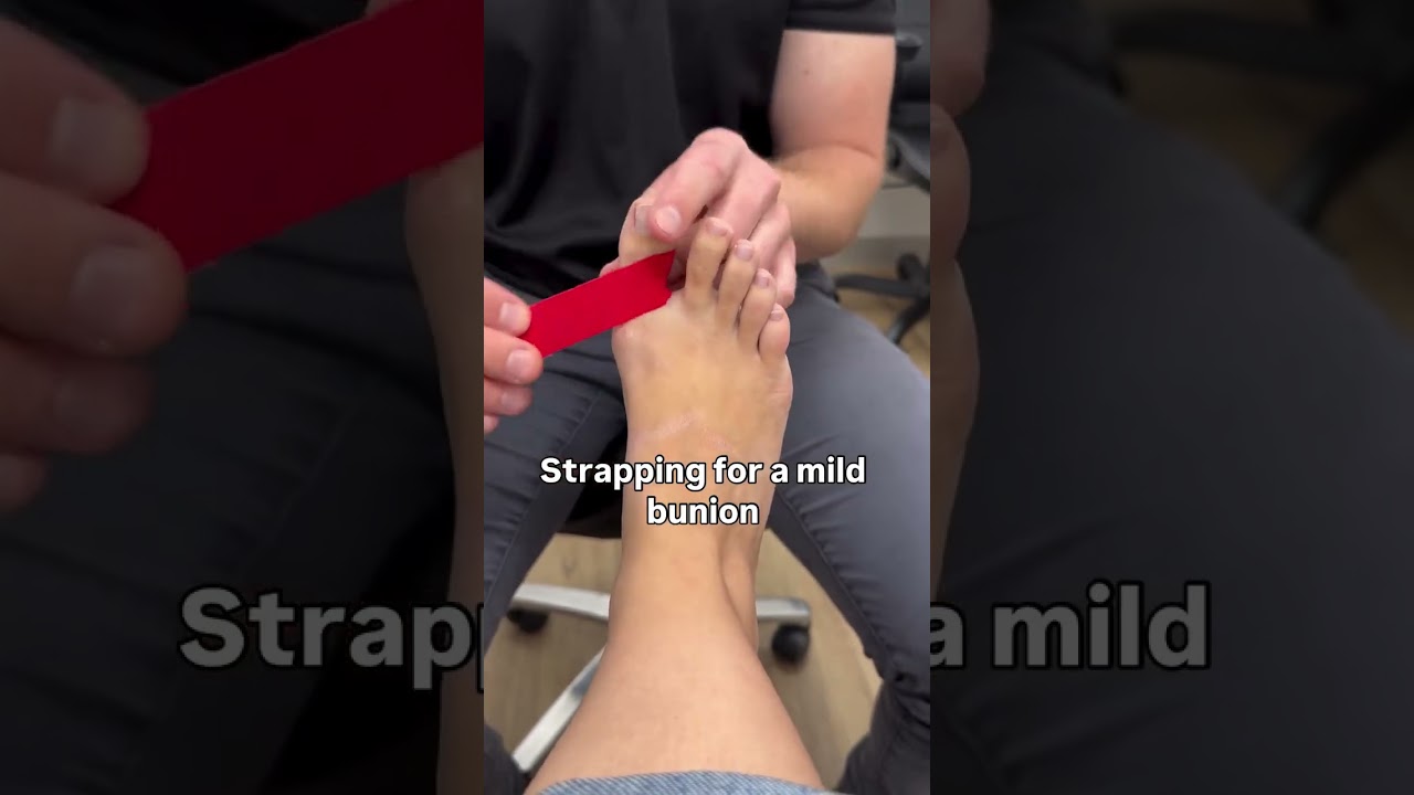 Taping For A Mild Bunion