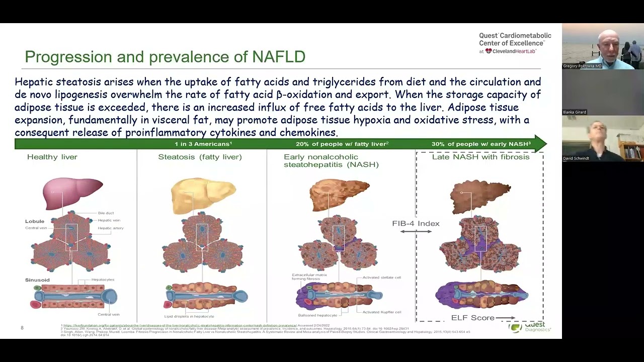 NAFLD/NASH - Apr 2023