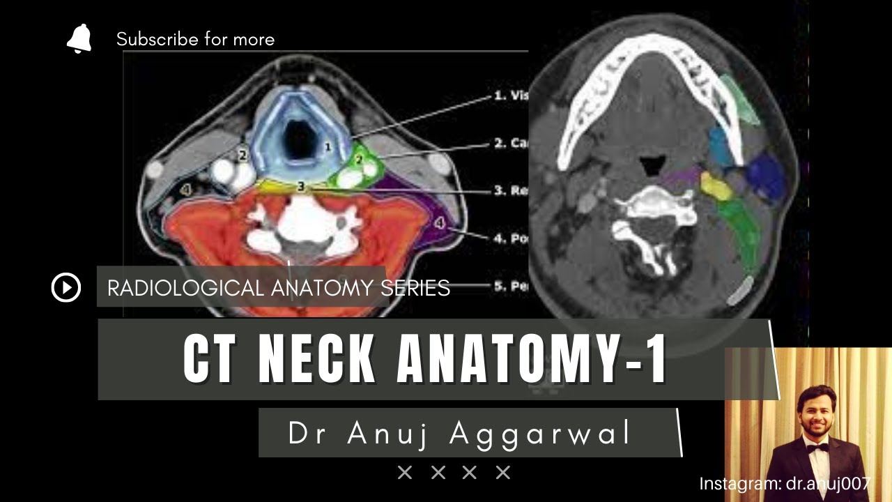 CT Neck Anatomy (Radiology Basics)| Anuj Aggarwal