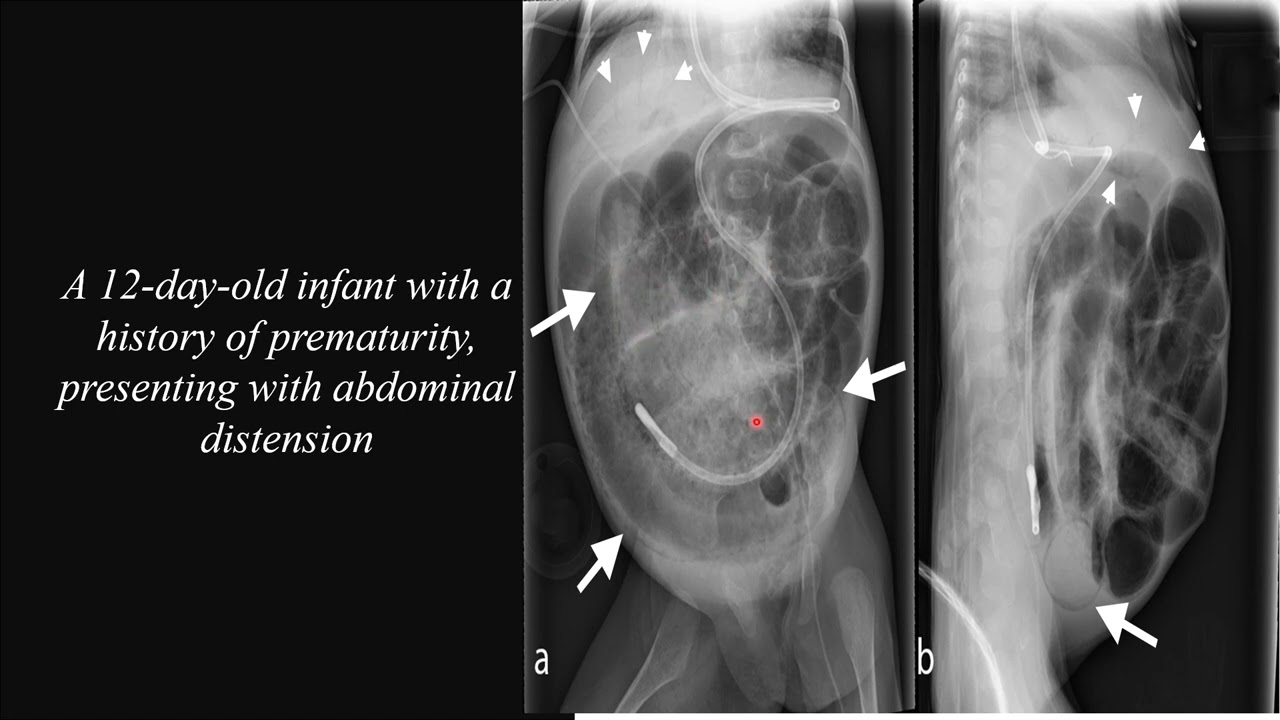 Pediatric Radiology Last-Minute Flash Cards