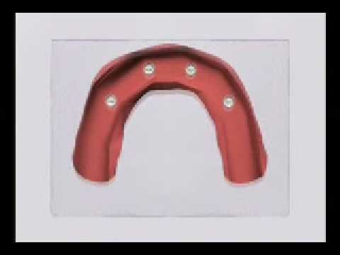 Video's over Prothesen - De Smile Kliniek