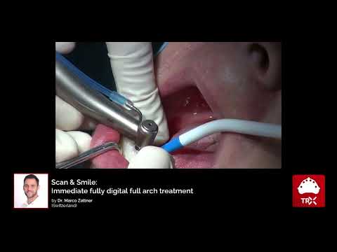 All matrix® Apps in 1 Case: "Scan & Smile - Immediate Fully Digital Full Arch Treatment"