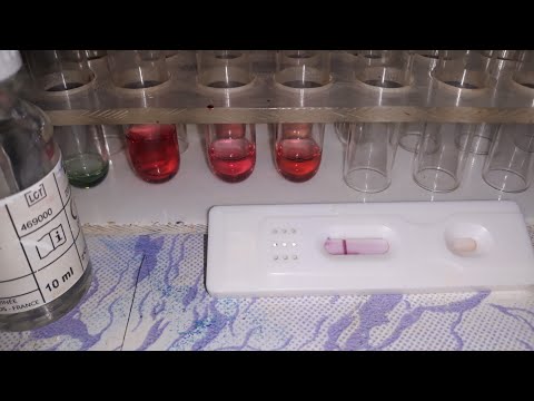 Typhoid Test Kit - Widal Test Kit Latest Price, Manufacturers & Suppliers