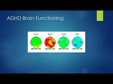 What Causes ADHD and Anxiety with Dr. Trish Leigh..