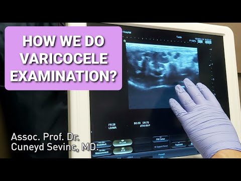 How we do #Varicocele Examination? Varicocele Diagnose with the help of Color Doppler Ultrasound?