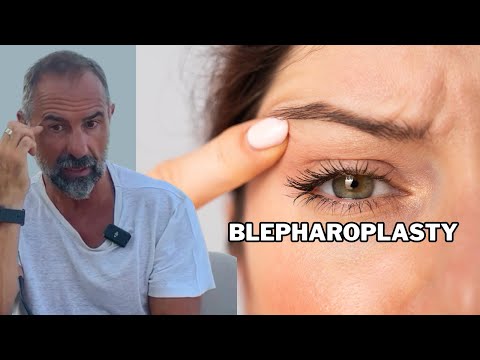 Blepharoplasty: Visible Scars? Everything You Need to Know ...