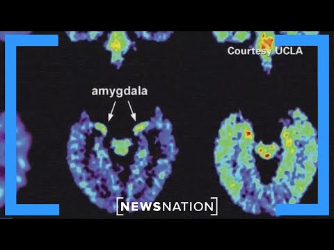Brain fog? Here’s how to beat it | Banfield