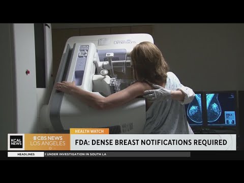 Health Watch: New FDA breast-density mammography regulations