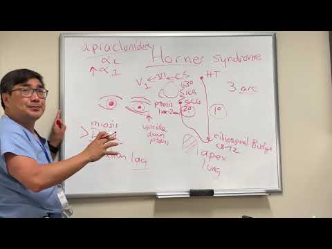 Horner Syndrome
