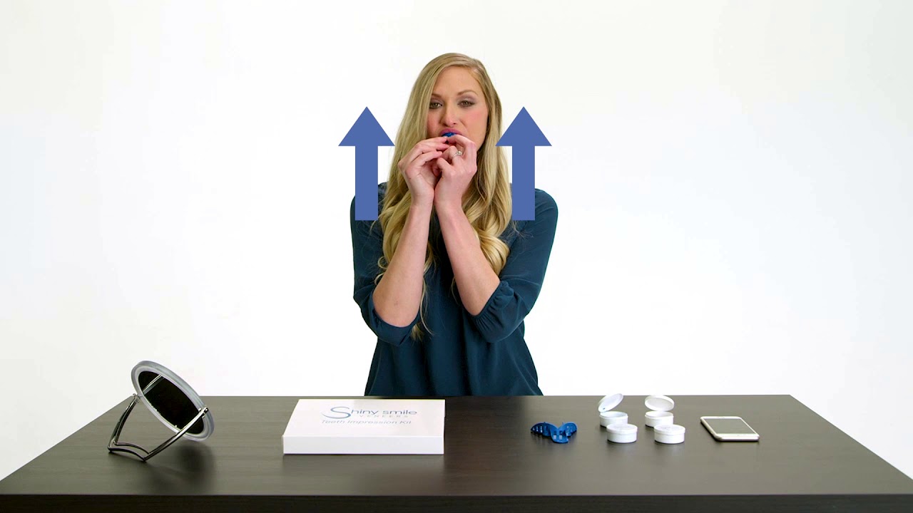 Instructions For Making A Good Impression For Your Removable Veneers