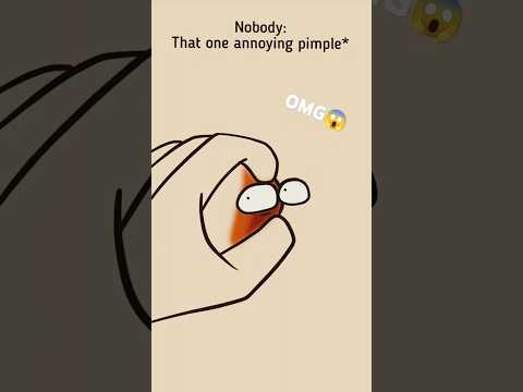 🔥OMG😱#shots #viral #comedy