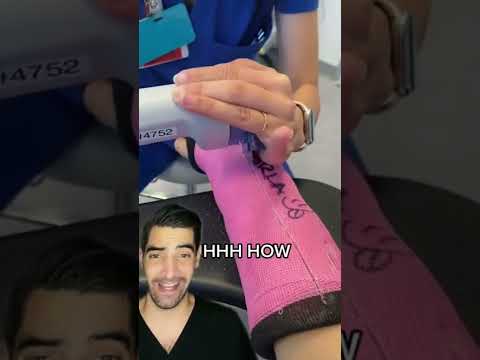 Cast coming off for a wrist break
